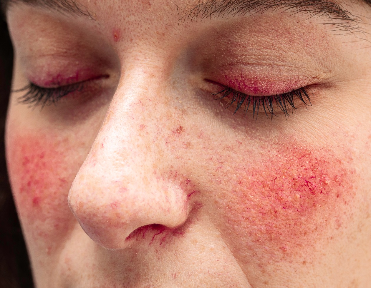 Amman Dermatologist | Dr. Maha Marji